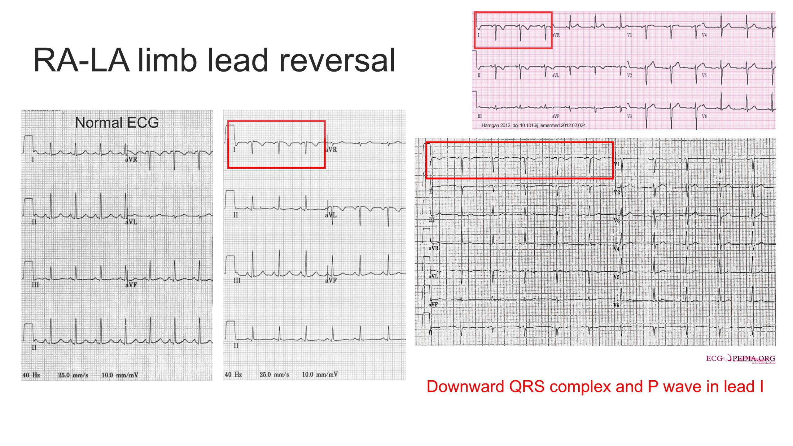 ECG – Pediatric Procedures